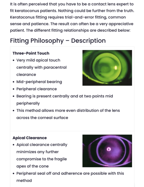 Bitoric / High Astigmatism Tools and Resources - GPLI